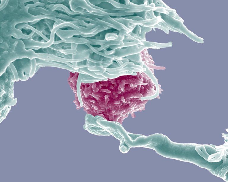 Legătura dintre bacteriile din intestine și lupta cu cancerul