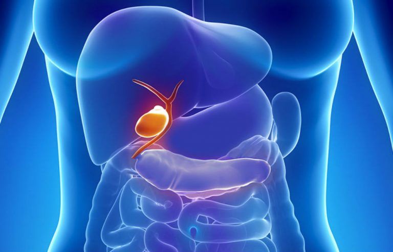 Pietre la fiere. Soluția naturală pentru eliminarea lor fără operație ...