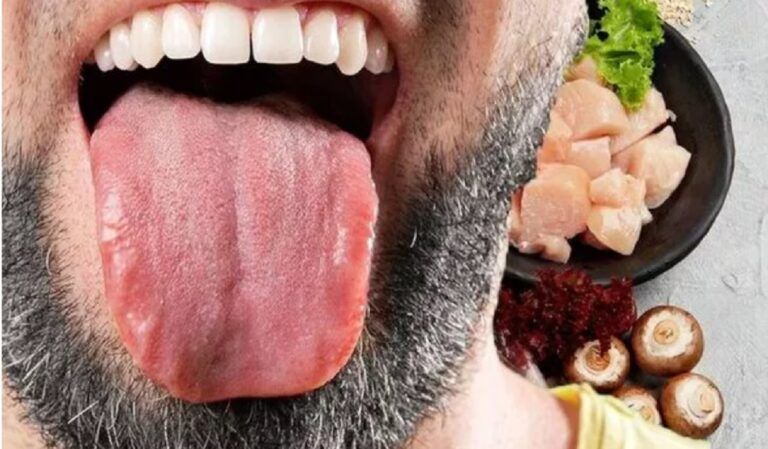 Cancerul de limbă: tot ce trebuie să știi despre acest cancer al ...