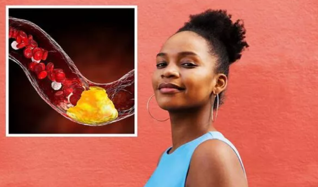 Simptome de colesterol ridicat: Semnul de avertizare care apare cel mai ...