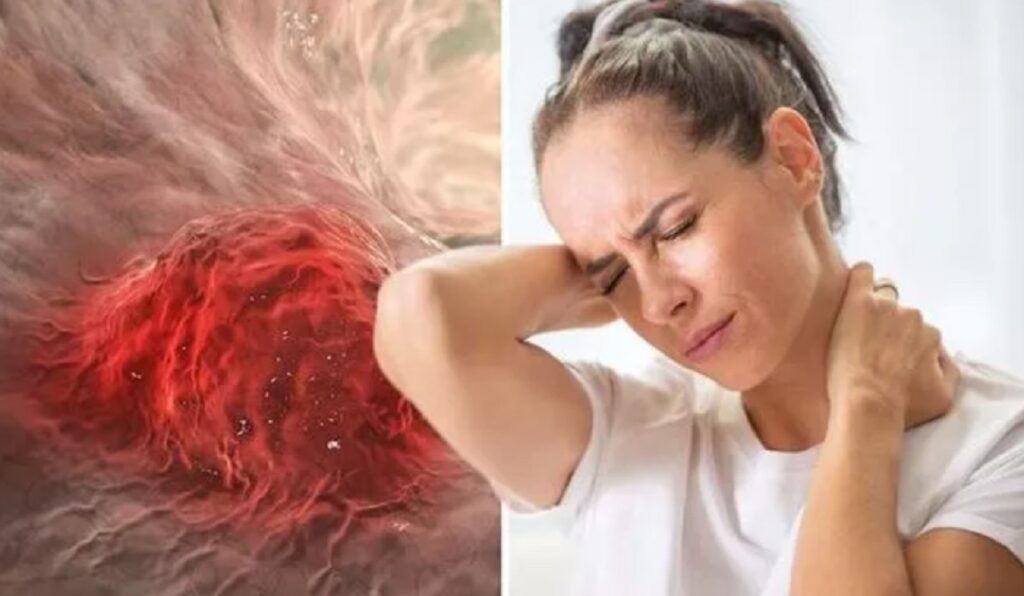 Simptome de cancer: semnul „brusc” pe care îl puteți observa când vă ...