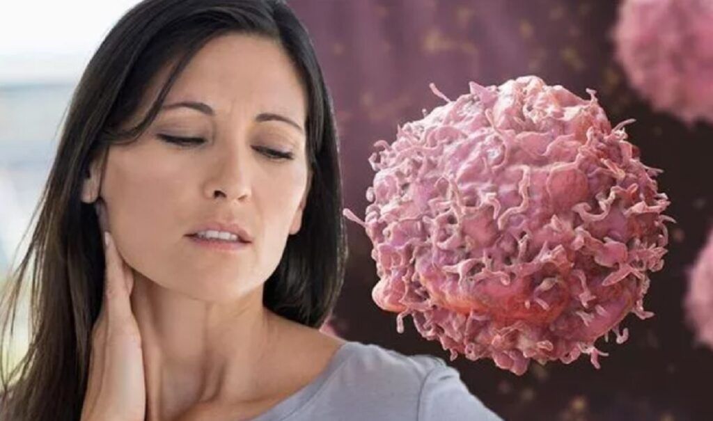 Cancer de amigdale: semnul nedureros din gât. Atenție și la durerea din ...