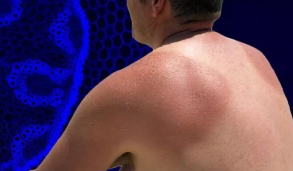 Simptome cancer. Atenție la aspectul buzelor iarna!