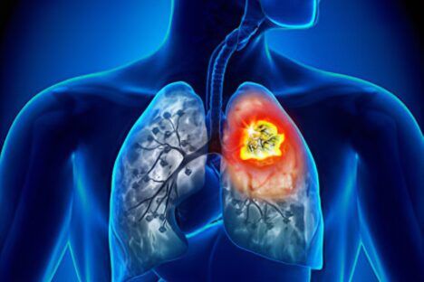 Medicamente & prospecte - DoctorulZilei