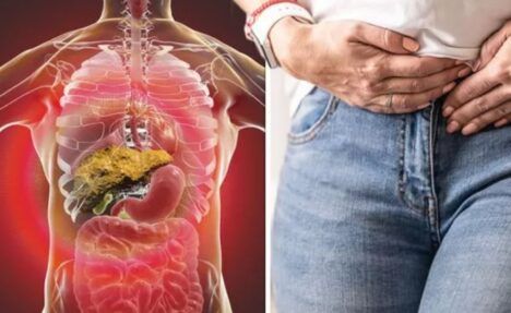 Ficatul gras: cele mai bune plante medicinale pentru vindecare naturală ...