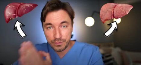 Cum vindeci ficatul gras și bolnav, potrivit medicului Mihail Pautov: „E ceva ce funcționează ...