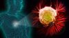 O nouă metodă revoluţionară de tratare a cancerului
