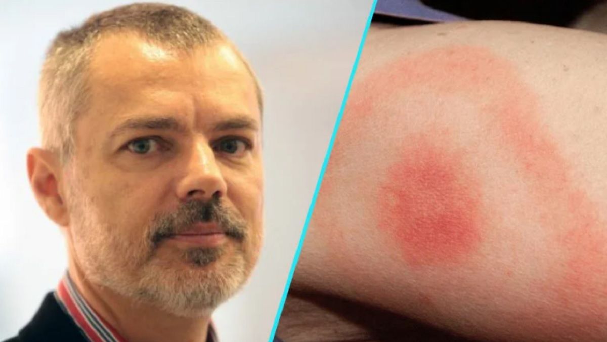 Mihai Craiu și teama de căpuse: Vom crește niște anxioși