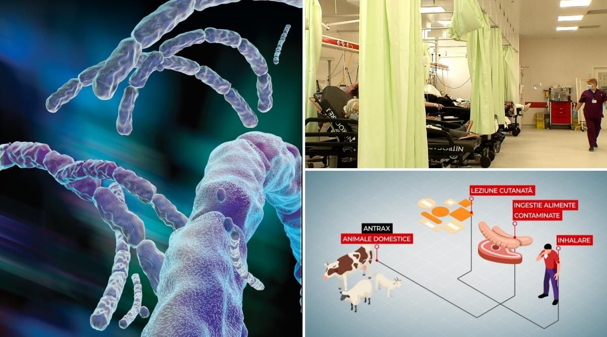 ALERTĂ EPIDEMIOLOGICĂ antrax la Iași. Simptome boala fatală