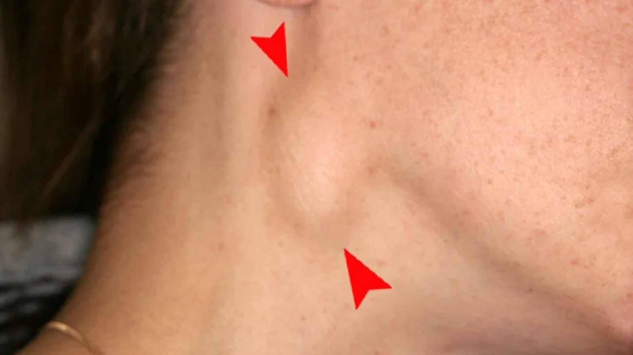 Ganglionii limfatici – DoctorulZilei