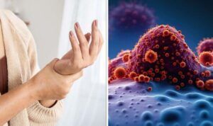 Te dor oasele? Poate fi un simptom al unor boli grave