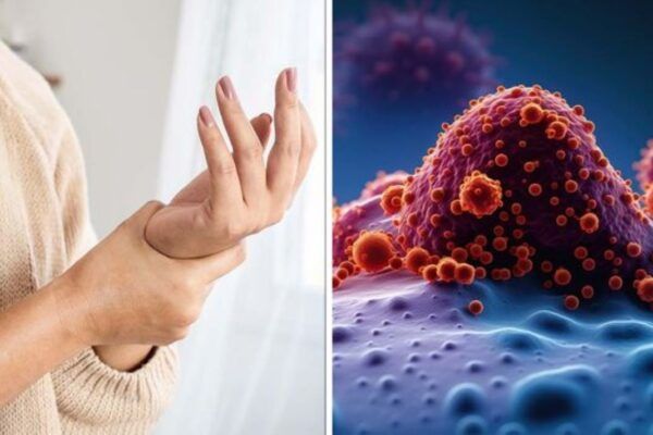 Medic: aceste semne de pe mâini și picioare indică un cancer