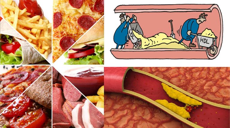 Ce alimente să consumi pentru scăderea colesterolului