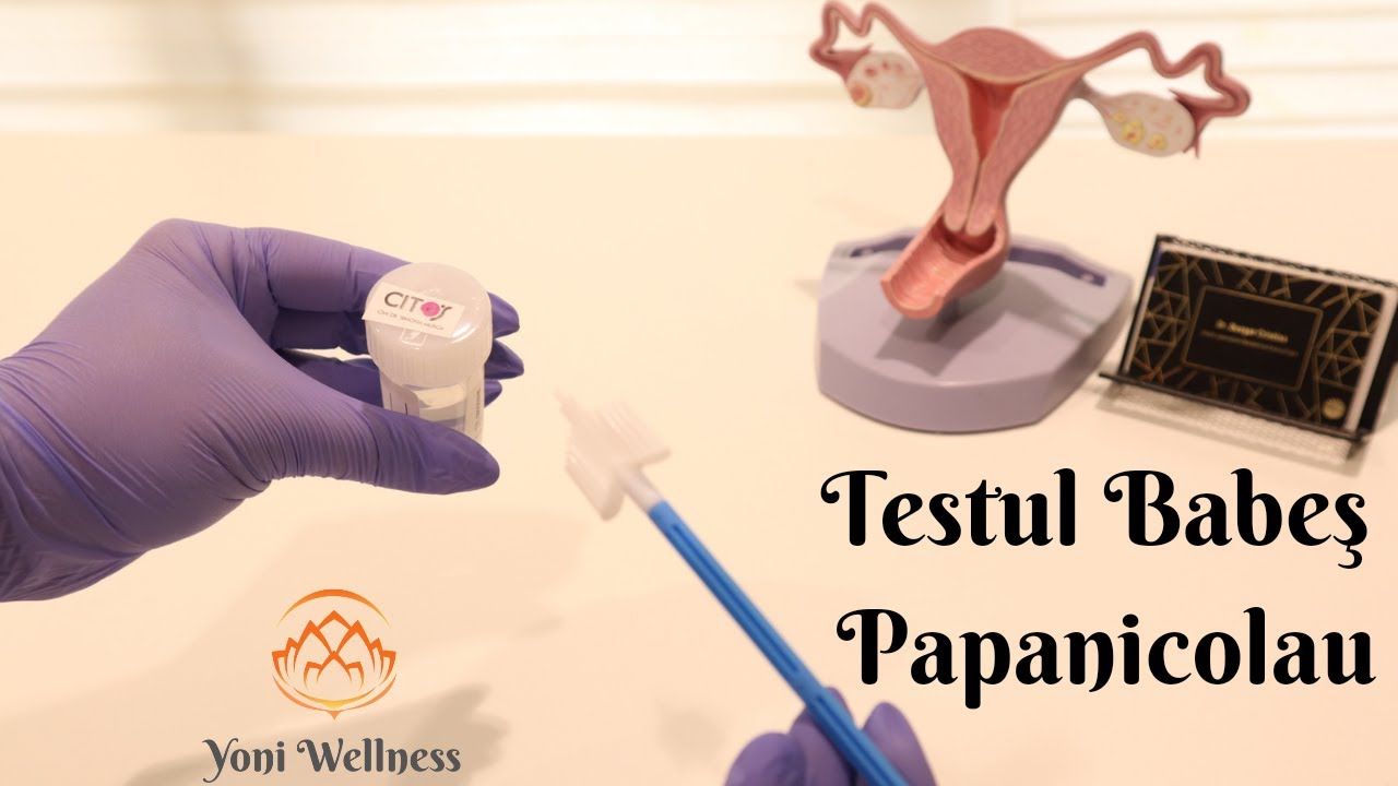 Unde se poate face GRATUIT testul Babeş-Papanicolau (PAP), doar cu ...