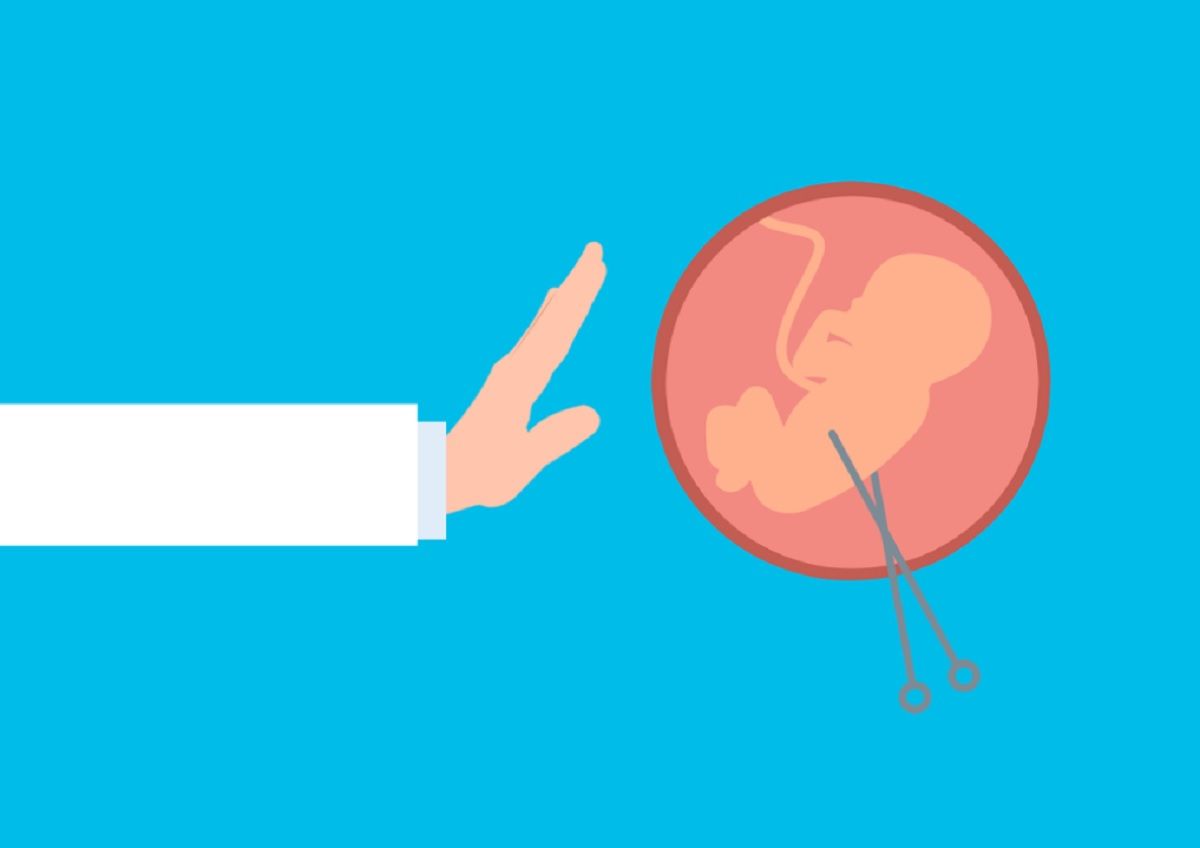 Prezentarea generală a opțiunilor de avort