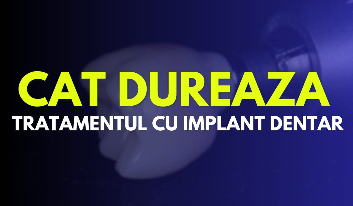 De la Implant la Coroana: Cat dureaza tot tratamentul? De la Implant la Coroana: Cat dureaza tot tratamentul?
