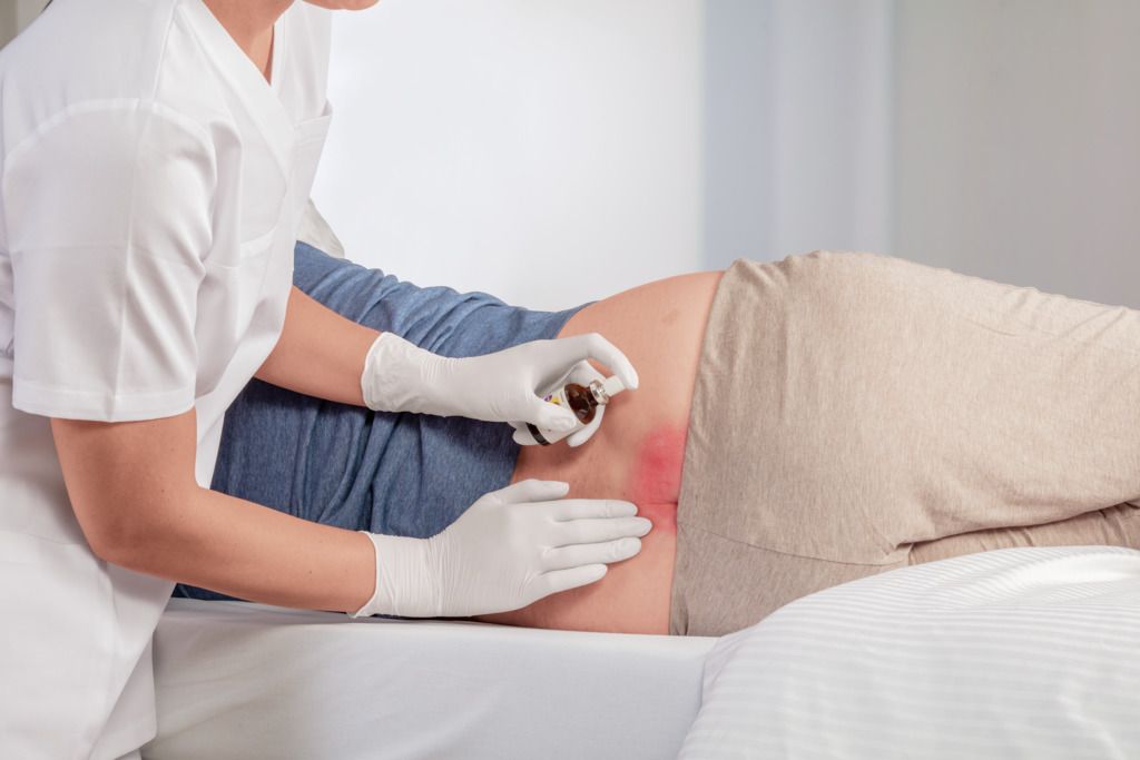 Escarele – Tot ce trebuie să știi despre ulcerele de presiune și ...