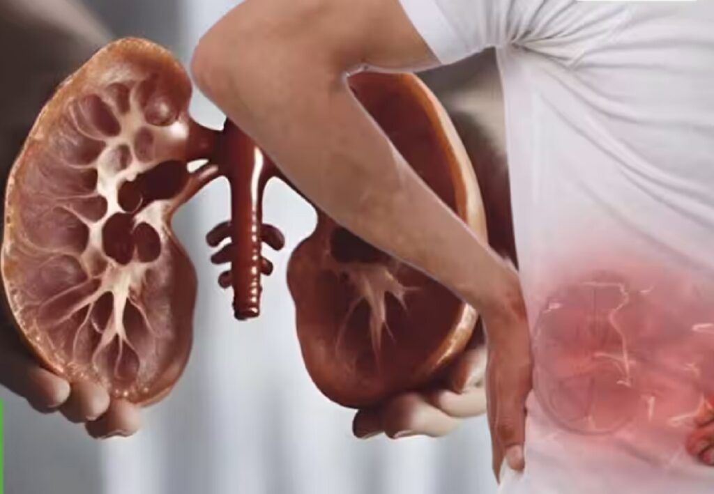 Top 9 alimente care curăță natural rinichii. Alimente recomandate ...