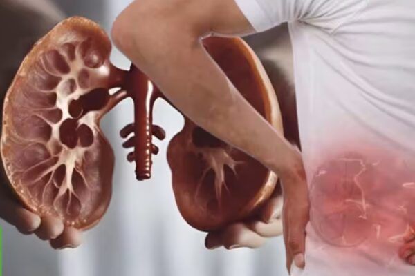 Top 9 alimente care curăță natural rinichii. Alimente recomandate ...