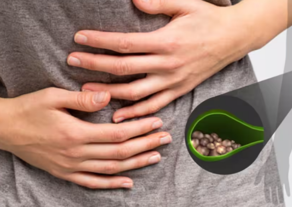 Remedii naturale pentru pietrele la rinichi. Cum să previi și să ...