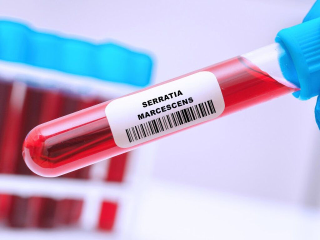 Serratia marcescens: bacteria mortală care a ucis șase copii la Iași ...