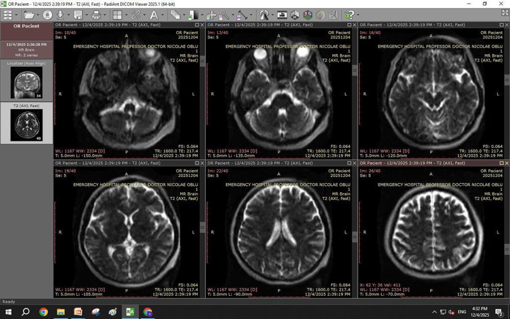 Premiera medicală națională: Diagnostic rapid cu primul RMN mobil ...